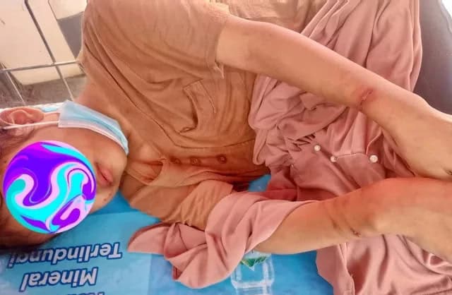 Mengenaskan, Diduga Dianiaya Orang Tua Tiri, Remaja di Cikokol dengan ...